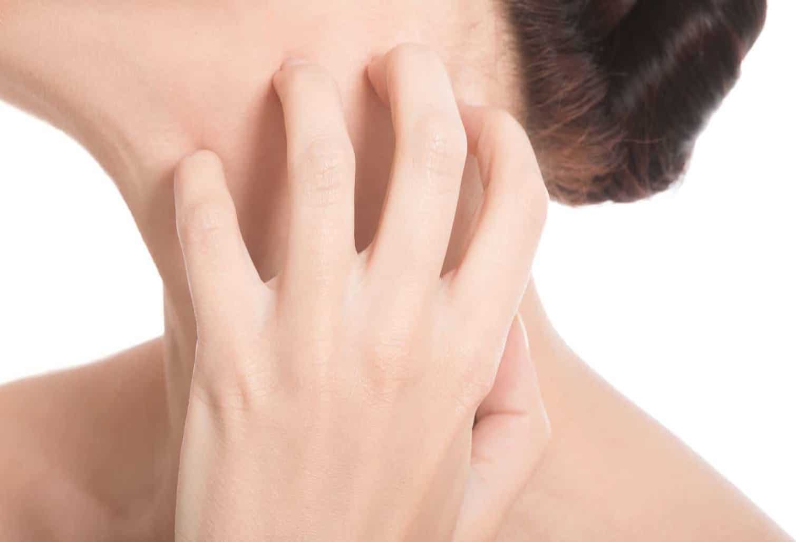 6 Common Summer Skin Rashes | Short Hills Dermatology