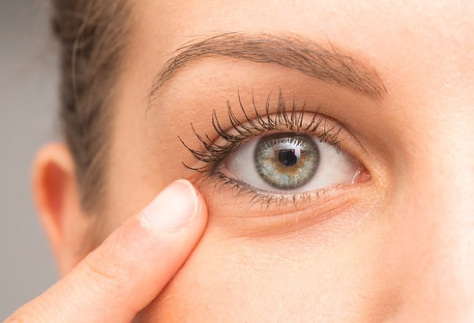 What Causes Under-Eye Hollows and How Can They Be Treated?